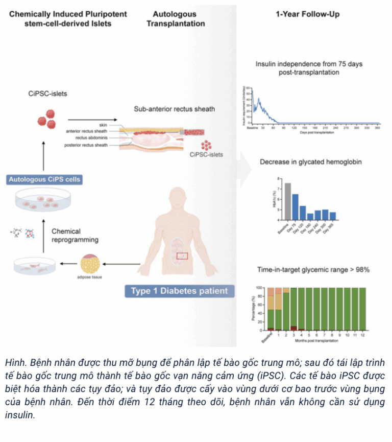 Liệu pháp tế bào gốc điều trị thành công bệnh tiểu đường type 1 lần đầu ...